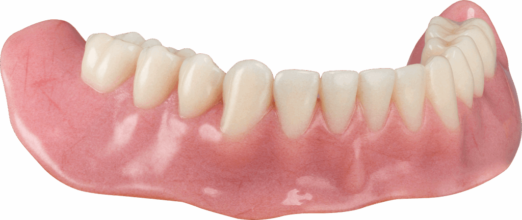 Totalprothese UK - NOVOPRINT